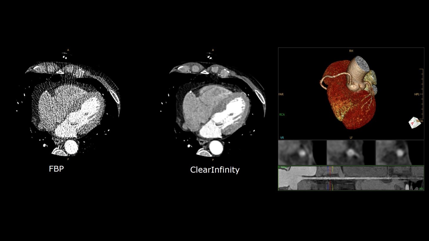 Neusoft Medical Systems: Enabling precision medicine with advanced ...